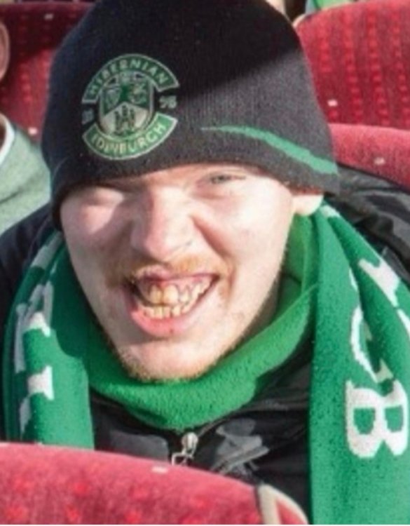 Funniest things about hibs - The Terrace - Jambos Kickback