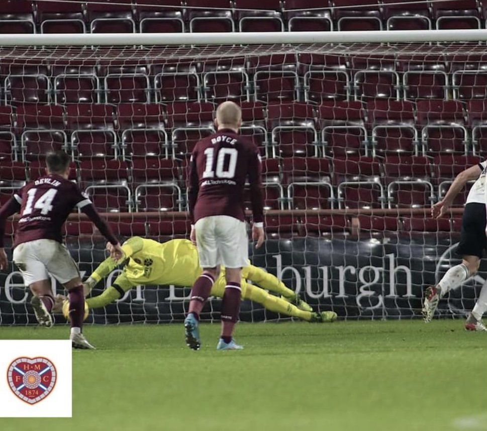 Craig Gordon double leg fracture confirmed - out for the season - The ...